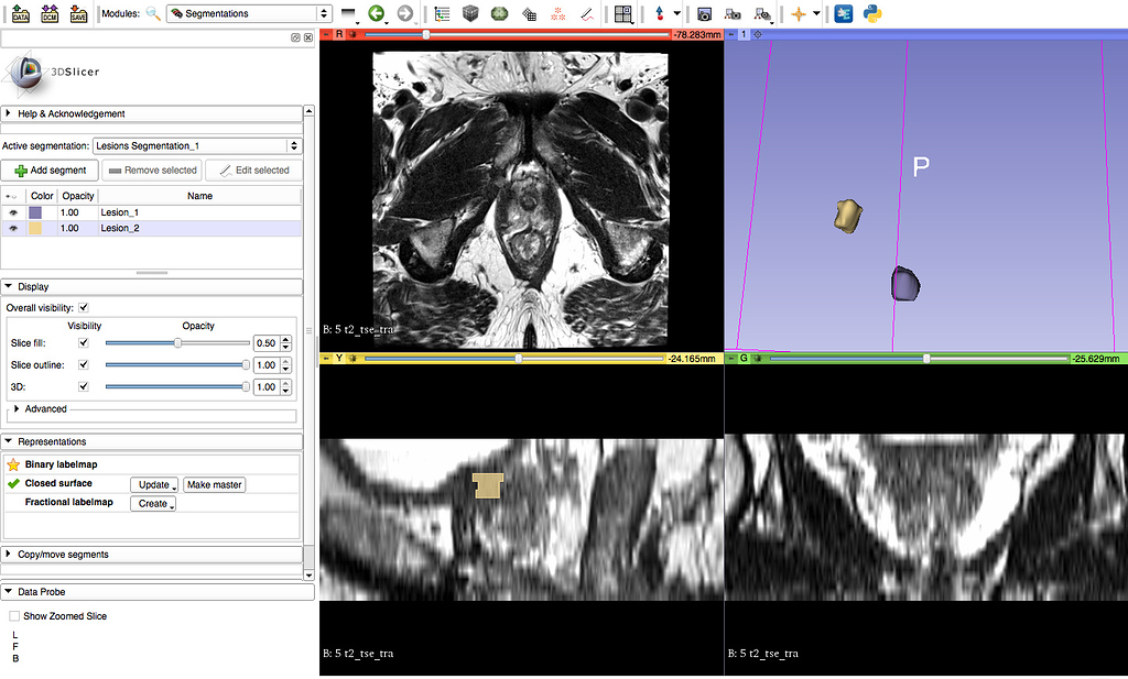 reading segmentation file from Slicer (NRRD) with multiple segments with SimpleITK shows ...