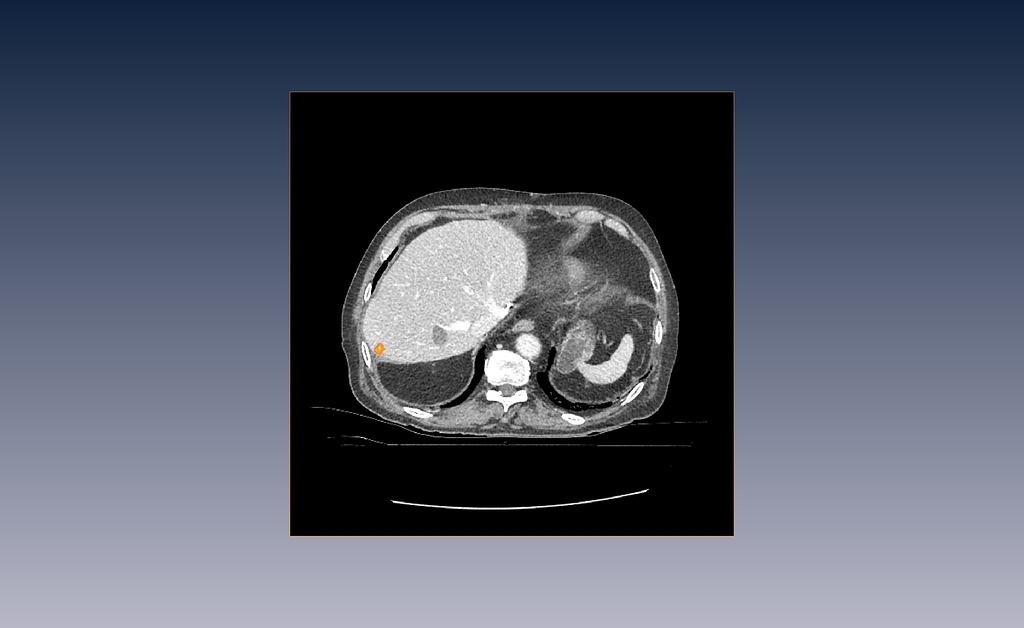 Resample To Same Spacing And Size And Align To Same Origin Beginner Questions Itk