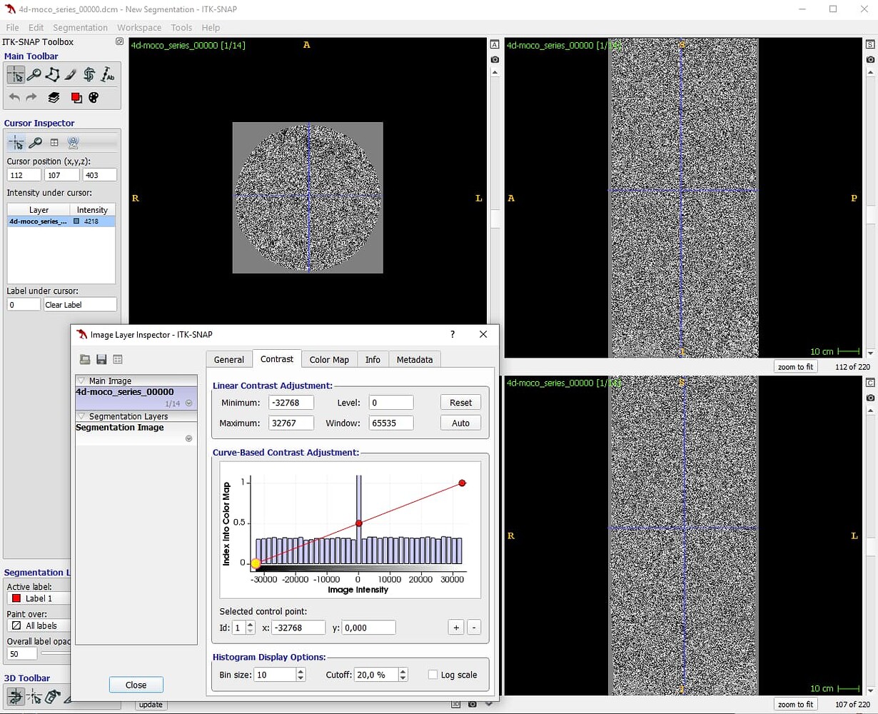 nifti to dicom conversion introduces negative intensities - Algorithms - ITK