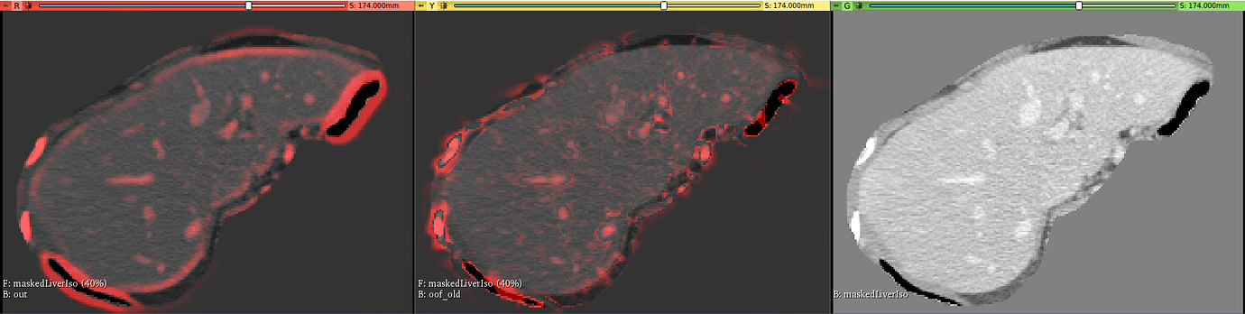 FFT mismatch ITK/matlab - Algorithms - ITK