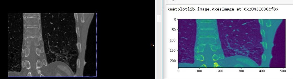 Mismatch Of Image View And Its Actual Dimensions Beginner Questions Itk