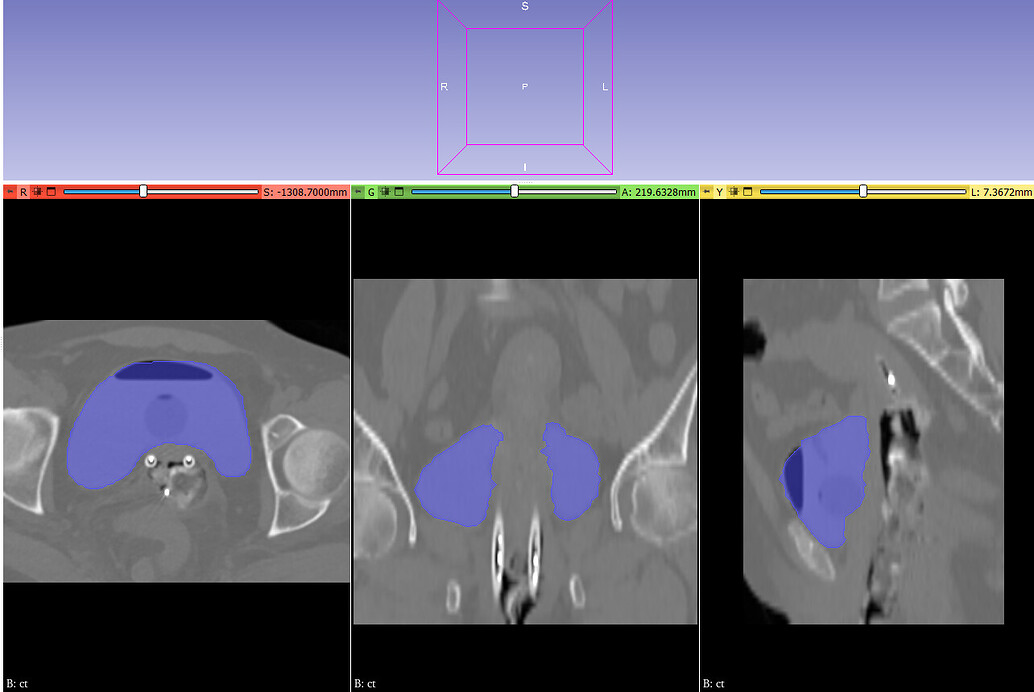 Overlaying Structures on CT Images in Axial, Coronal, and Sagittal ...