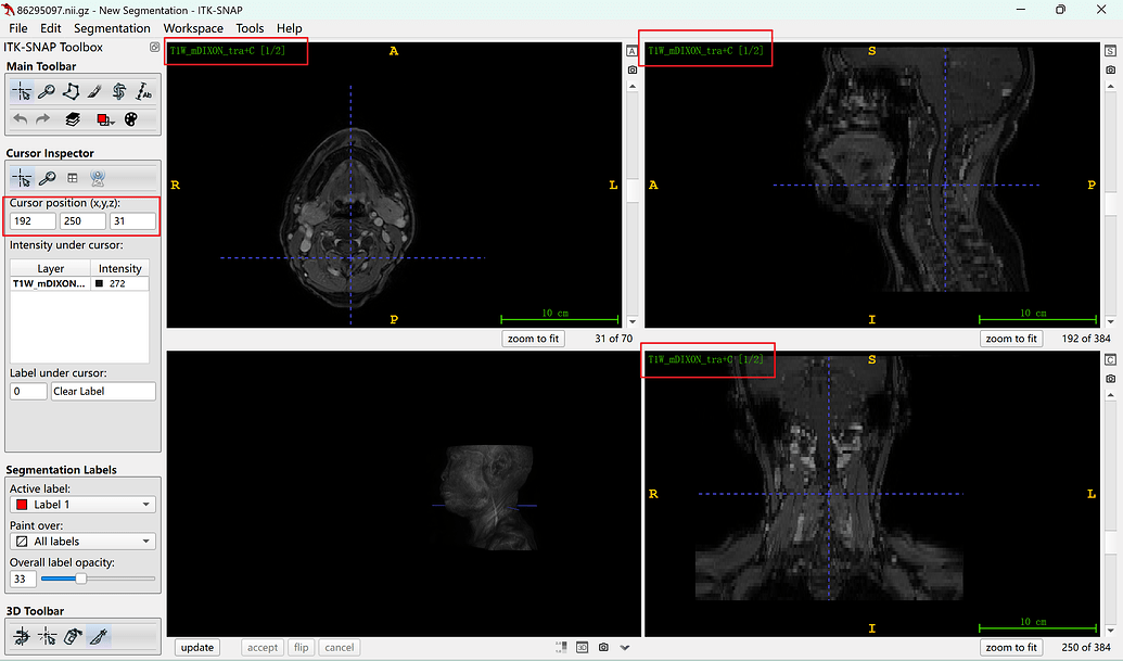 How to extract multiple components image from dicom series? - Beginner Questions - ITK