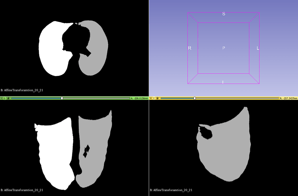 Bspline Free form deformable registration - Algorithms - ITK