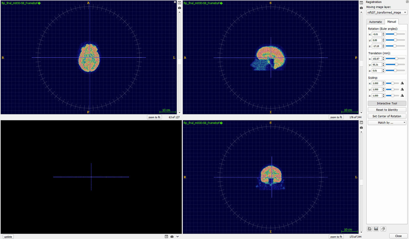 Difference between imposed motion (SimpleITK) and registration output ...