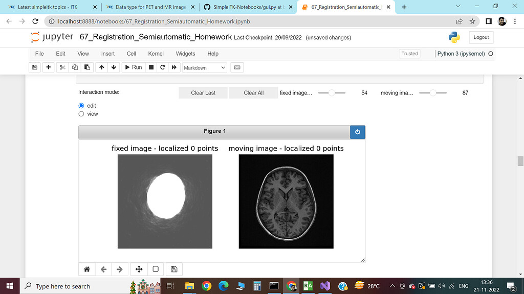 Trouble viewing PET image (mha file) in SimpleITK - Beginner Questions ...