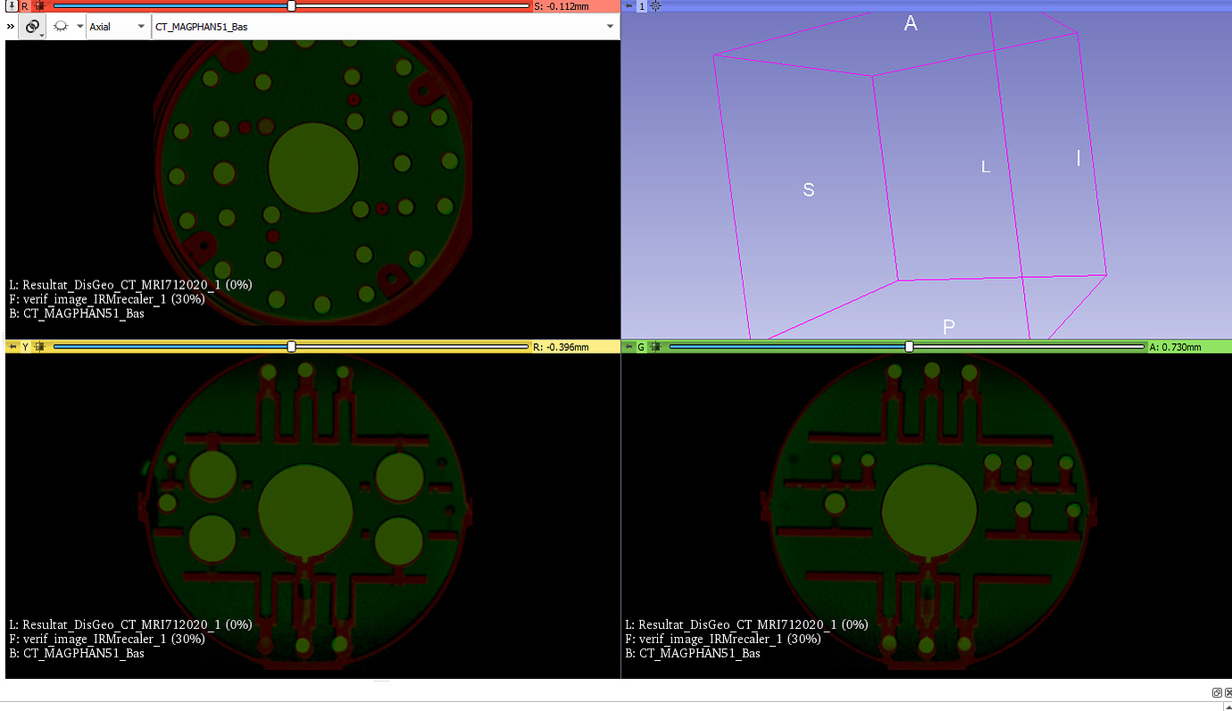 Registration Ct and MRI with multiresolution - Algorithms - ITK