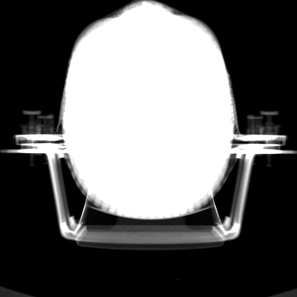 There are deviations between generated DRR image and corresponding EPID image - Algorithms - ITK