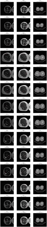 Using LandmarkBasedTransformInitializer for BSpline registrations - Algorithms - ITK