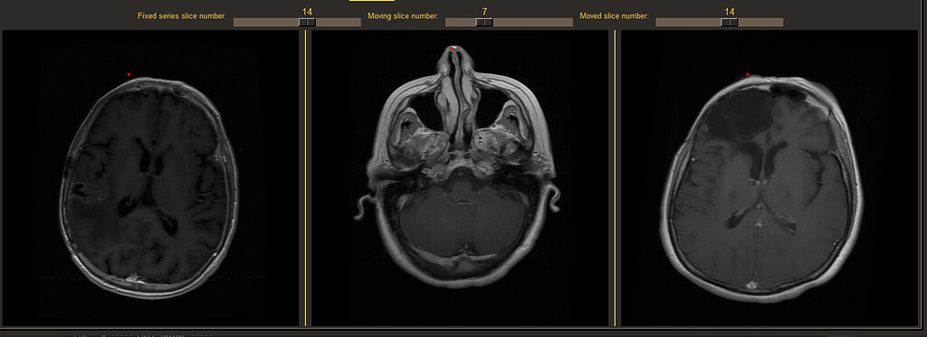 SimpleITK: Registration working but applying the transform to a single ...