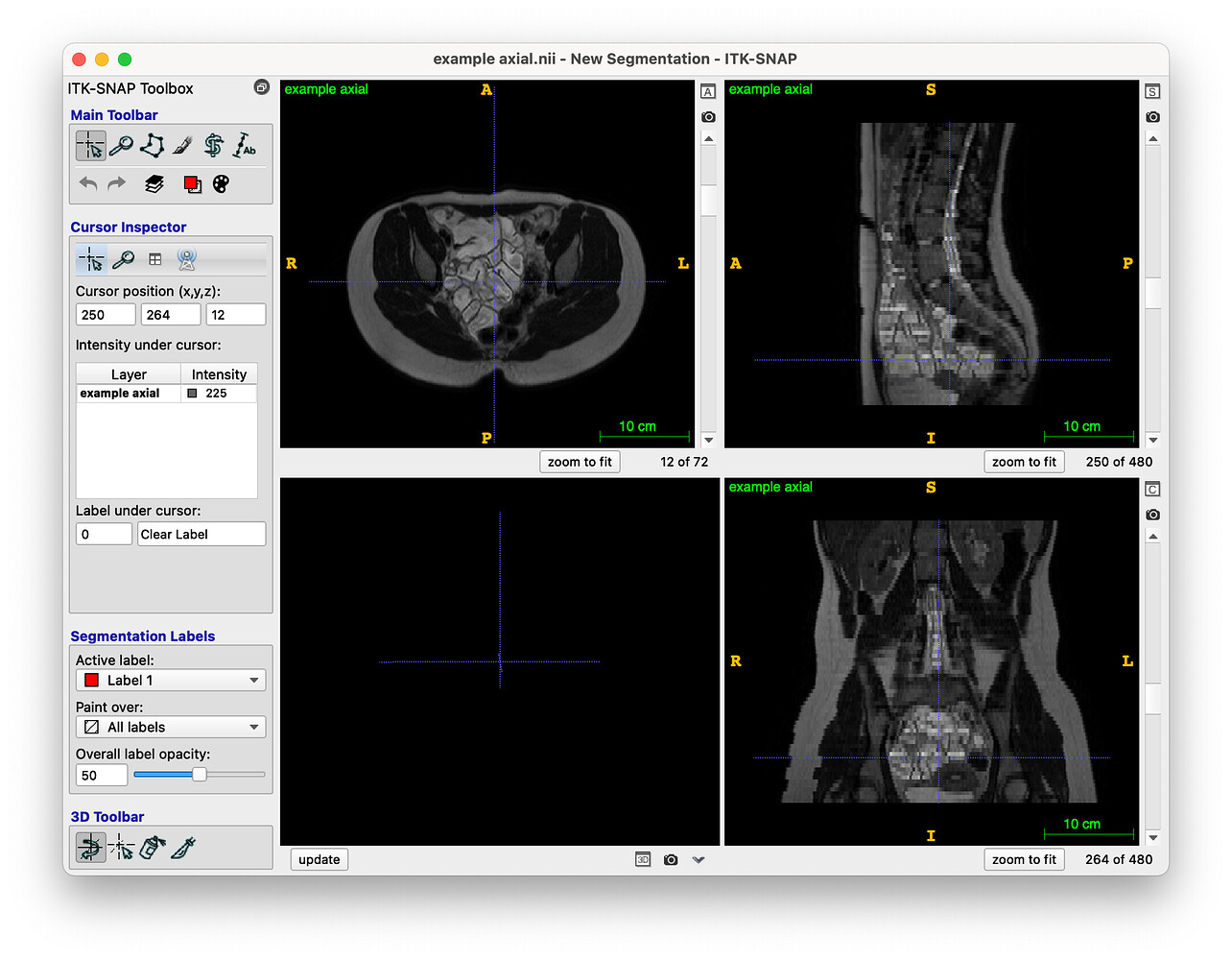 3D SLIC Visualisation - Beginner Questions - ITK